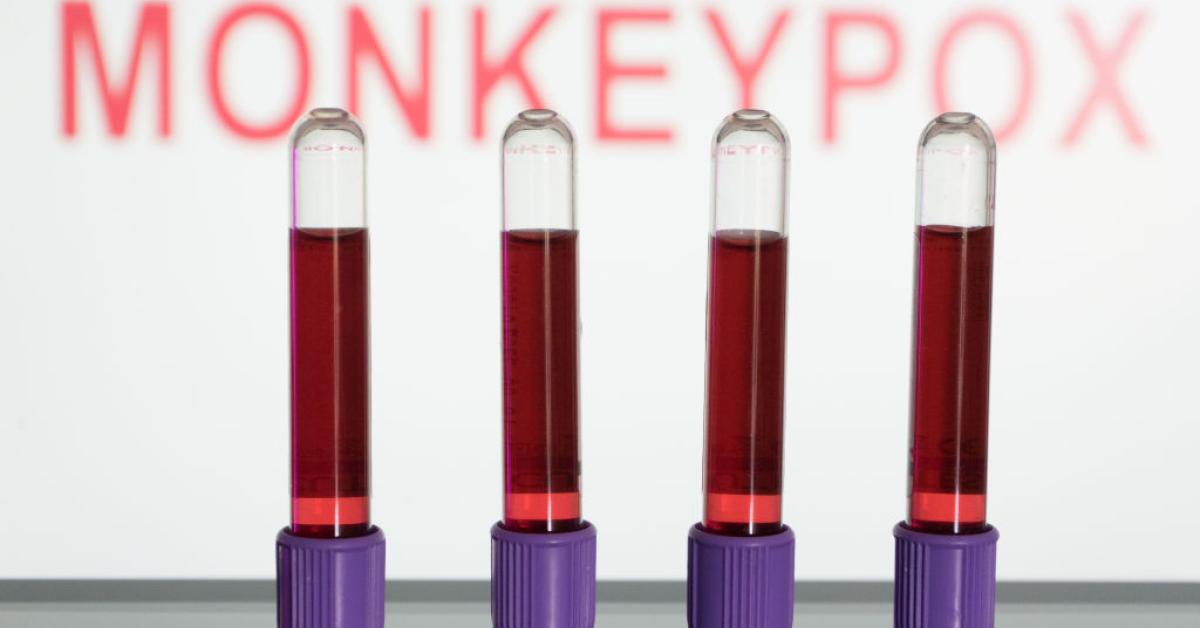 Speed over accuracy? COVID, monkeypox research would get less vetting ...